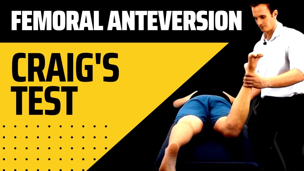Femoral Anteversion Retroversion Craig's Hip Test