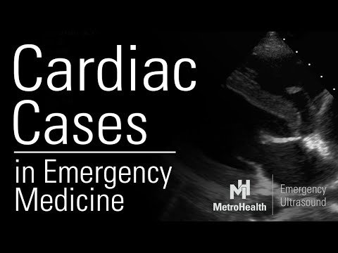 Cardiac Cases in Emergency Medicine