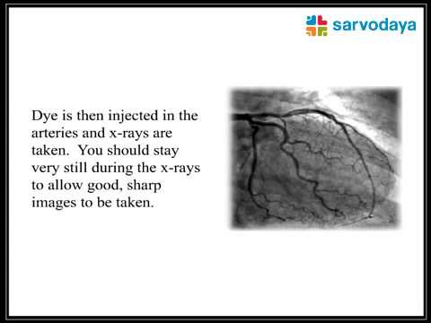 Coronary Angiography and Possible Angioplasty