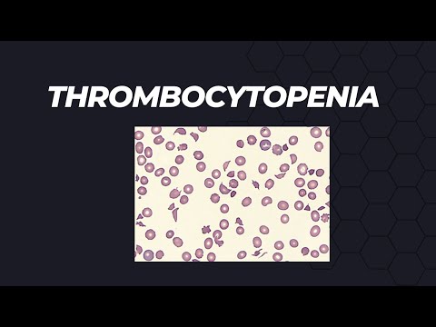 Thrombocytopenia