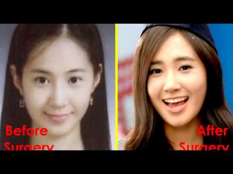 SNSD Before & After Plastic Surgery 2014 Ranked OFFICIAL HD