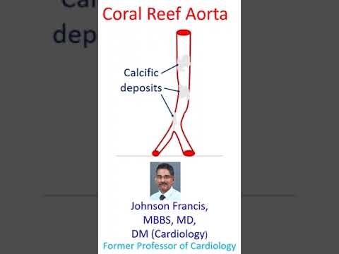 Coral Reef Aorta