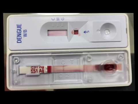 Dengue Test Kit - Dengue Rapid Test Latest Price, Manufacturers & Suppliers