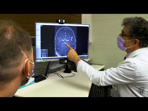 Mayo Clinic Minute - What is a subarachnoid hemorrhage