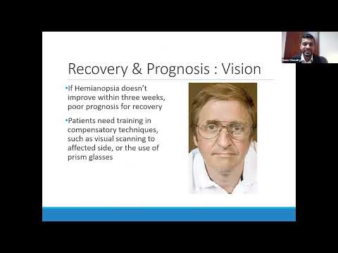 Grand rounds- Stroke rehabilitation- Dr. Haris Choudry- Jan 20, 2023