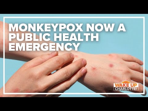 US declares public health emergency over monkeypox outbreak