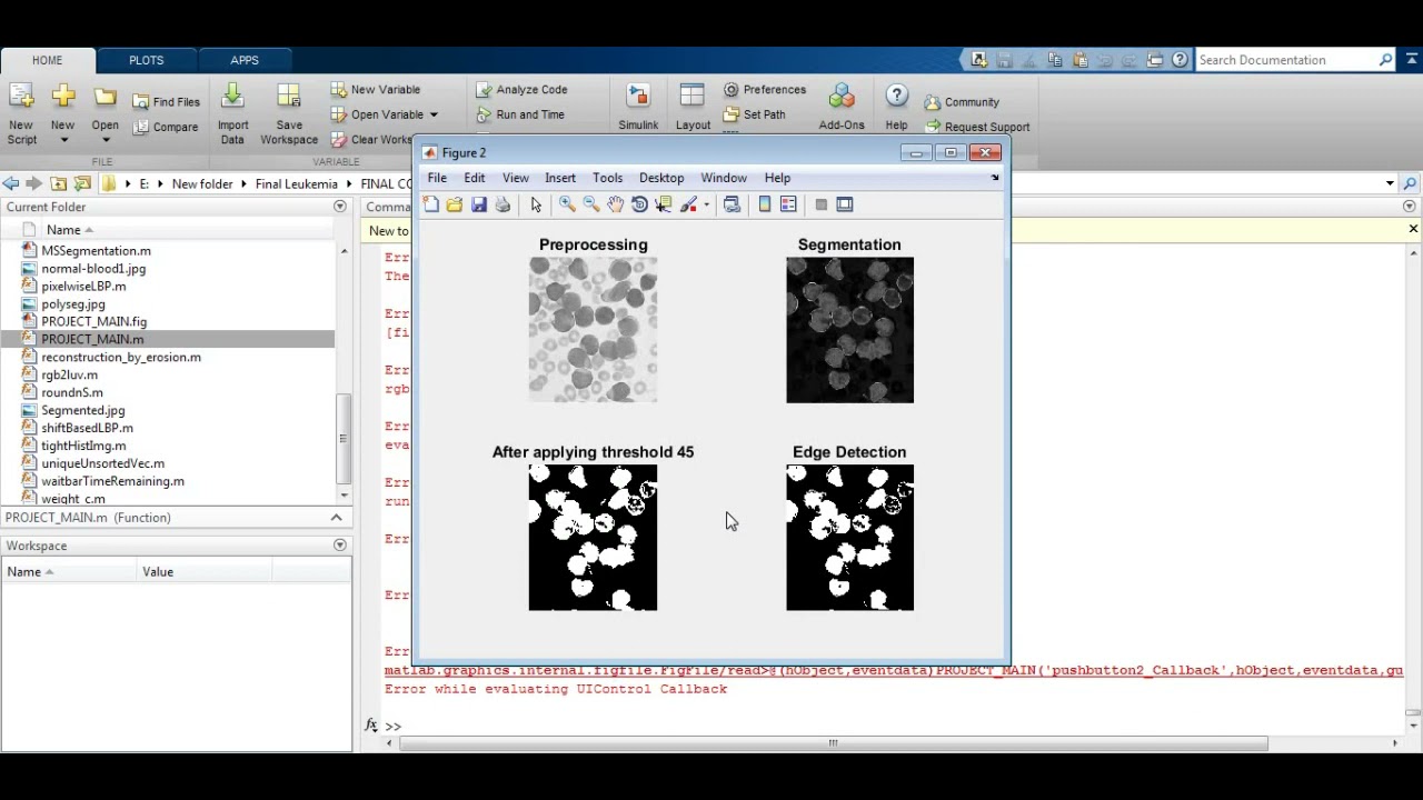 Early Detection and Classification of Leukemia using Image Processing