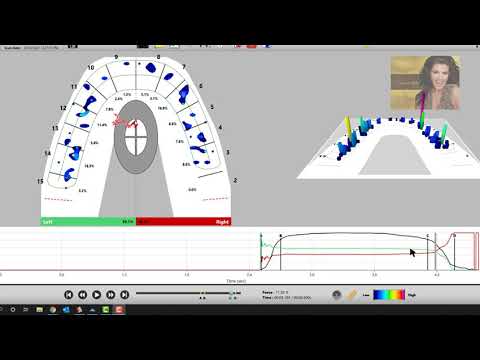 C and D Lines T-Scan