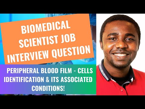 Peripheral Blood Film – Cells Identification and its associated conditions! #biomedicalscientist