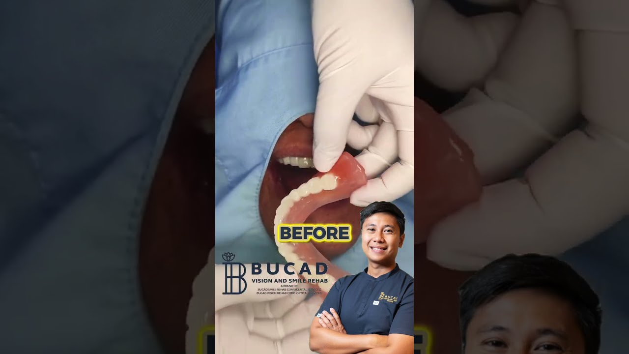 Before and after dental care