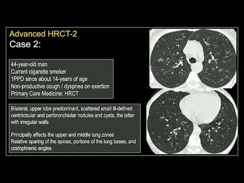 HRCT-2: Diffuse Smoking-Related Lung Diseases