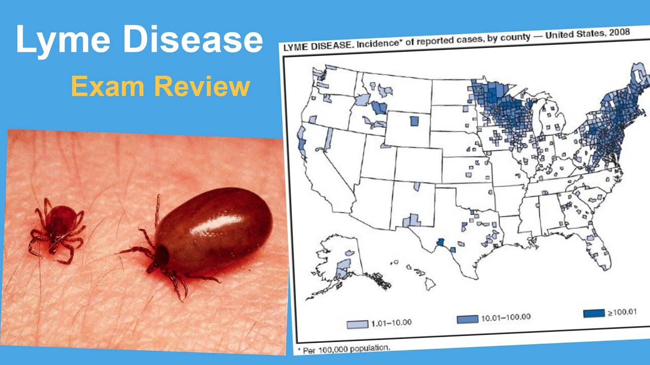 Lyme Disease Exam Review - Lindsay Andras, MD