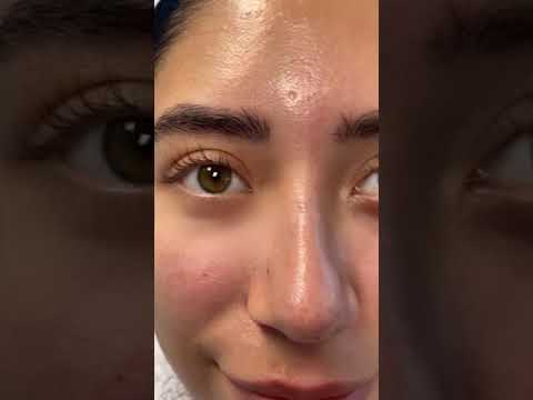 NATURAL UNDER EYE FILLER 👀