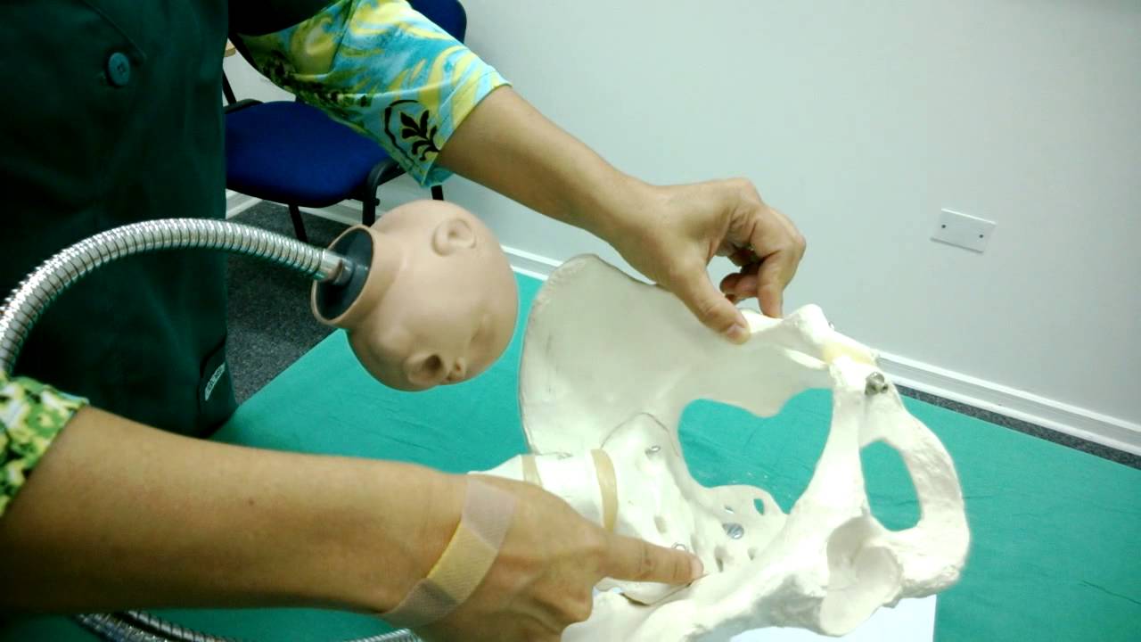 Diametros internos de la pelvis
