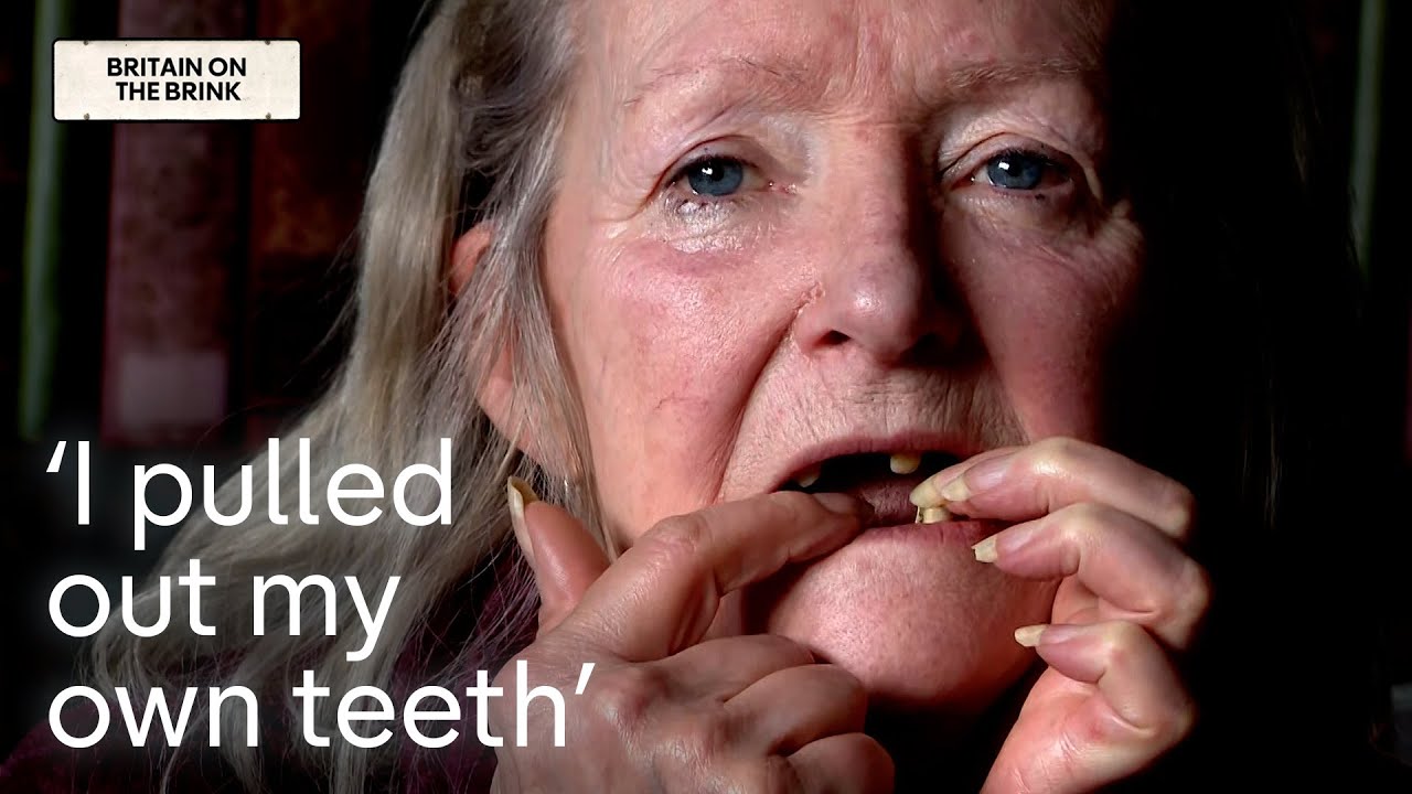 NHS dentist crisis forces some into extreme DIY treatment