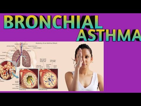 Bronchial asthma in hindi , definition, causes , symptoms.
