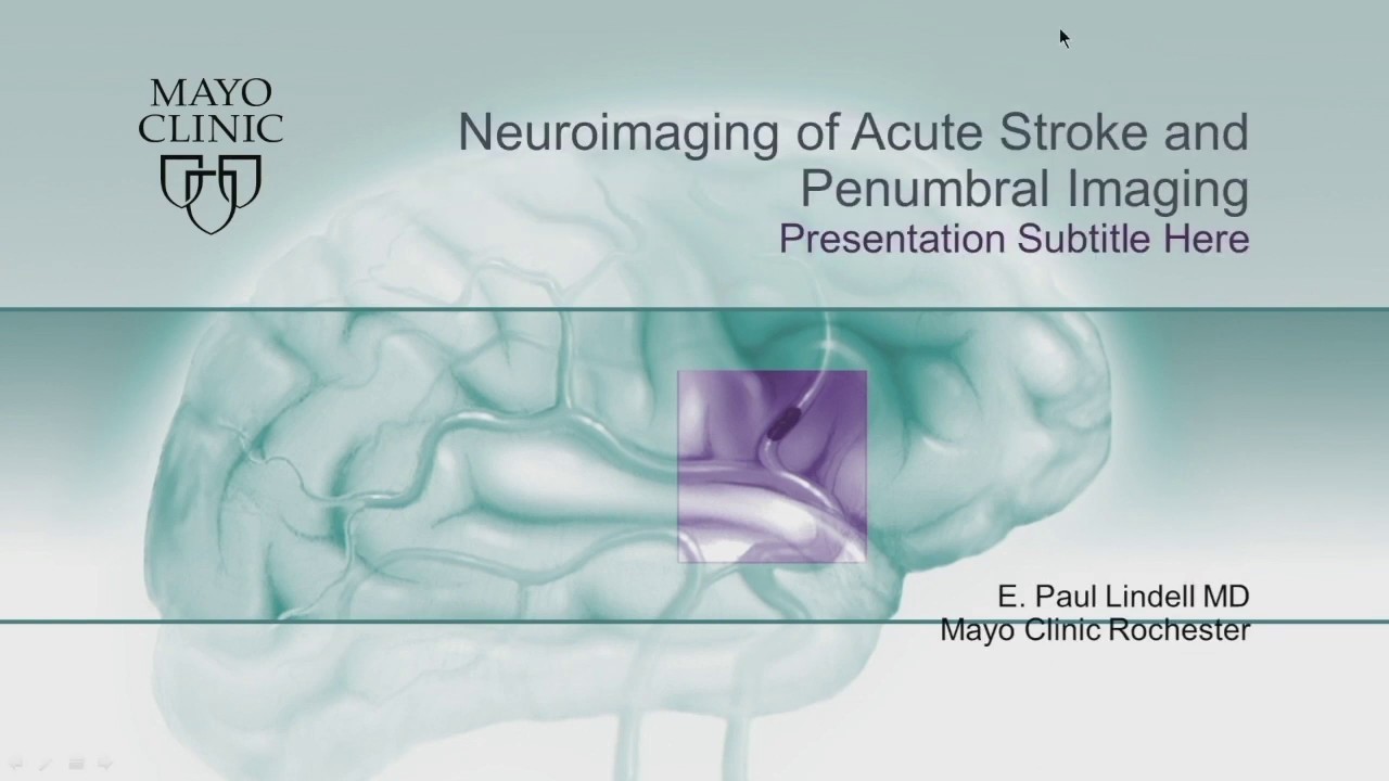 Neuroimaging of Acute Stroke & Penumbral Imaging by E. Paul Lindell, MD | Preview