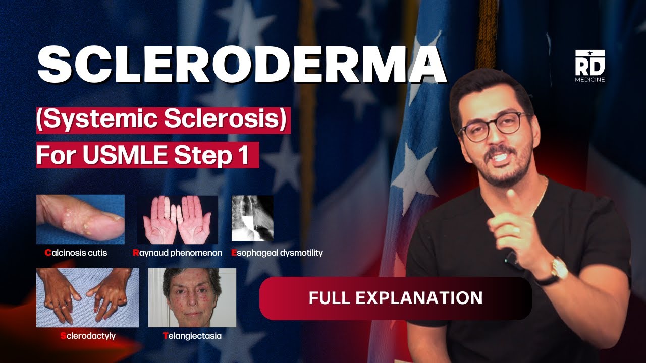 Scleroderma (Systemic Sclerosis) – High-Yield USMLE Step 1 Review