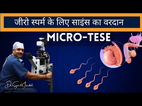 What is MICRO TESE|माइक्रो टेसे क्या है|Dr. Sunil Jindal|JindalHospital
