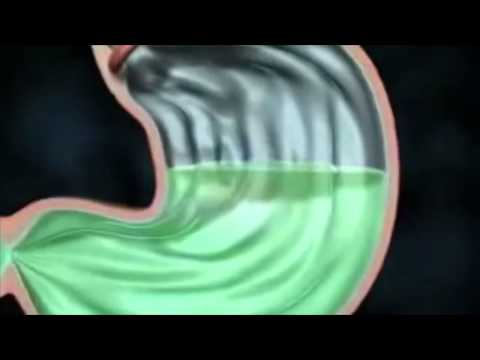 Aspirin: Good pill, bad pill (aluminium) - FINAL
