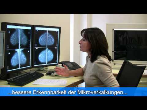 New Screens Result In Improved Diagnosis At Bielefeld DIRANUK Mammography Screening Centre, Germany