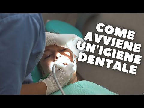COME AVVIENE UN’IGIENE DENTALE ? Servizio Offerto dal F-Medical Group di Frosinone
