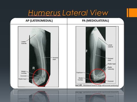 Humerus AP/Lateral Radiograph Image How to Critique - PACEMAN METHOD