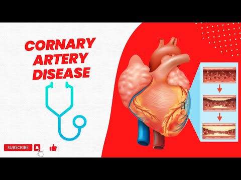 What is coronary artery disease?