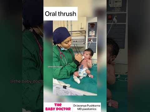 White patches in oral cavity of a newborn | oral thrush #newborn #babyvideos #ytshorts #drlavanya