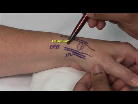 1st CMC Joint Injection