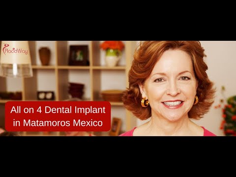 All on 4 Dental Implants in Matamoros, Mexico
