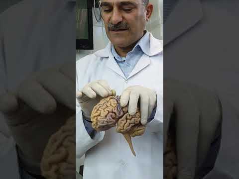 functional areas of cerebral cortex