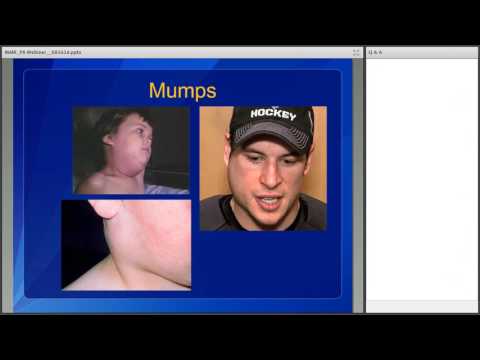 Measles, Mumps, Rubella