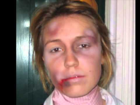 La violence conjugale
