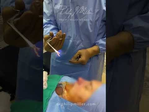 Deviated Septum, Why You Must Get It Fixed!