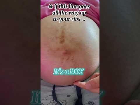 Linea Nigra Predicts Gender #shorts  #pregnancy  #baby