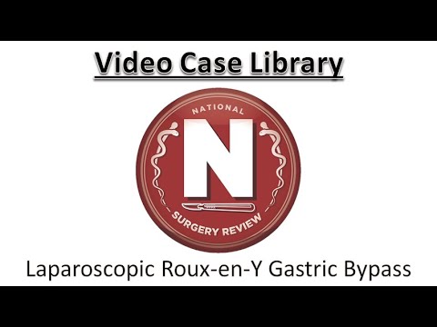 Laparoscopic Roux-en-Y Gastric Bypass