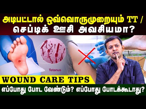 Is TT injection necessary after each wound / injury? Wound care TIPS | Dr. Arunkumar