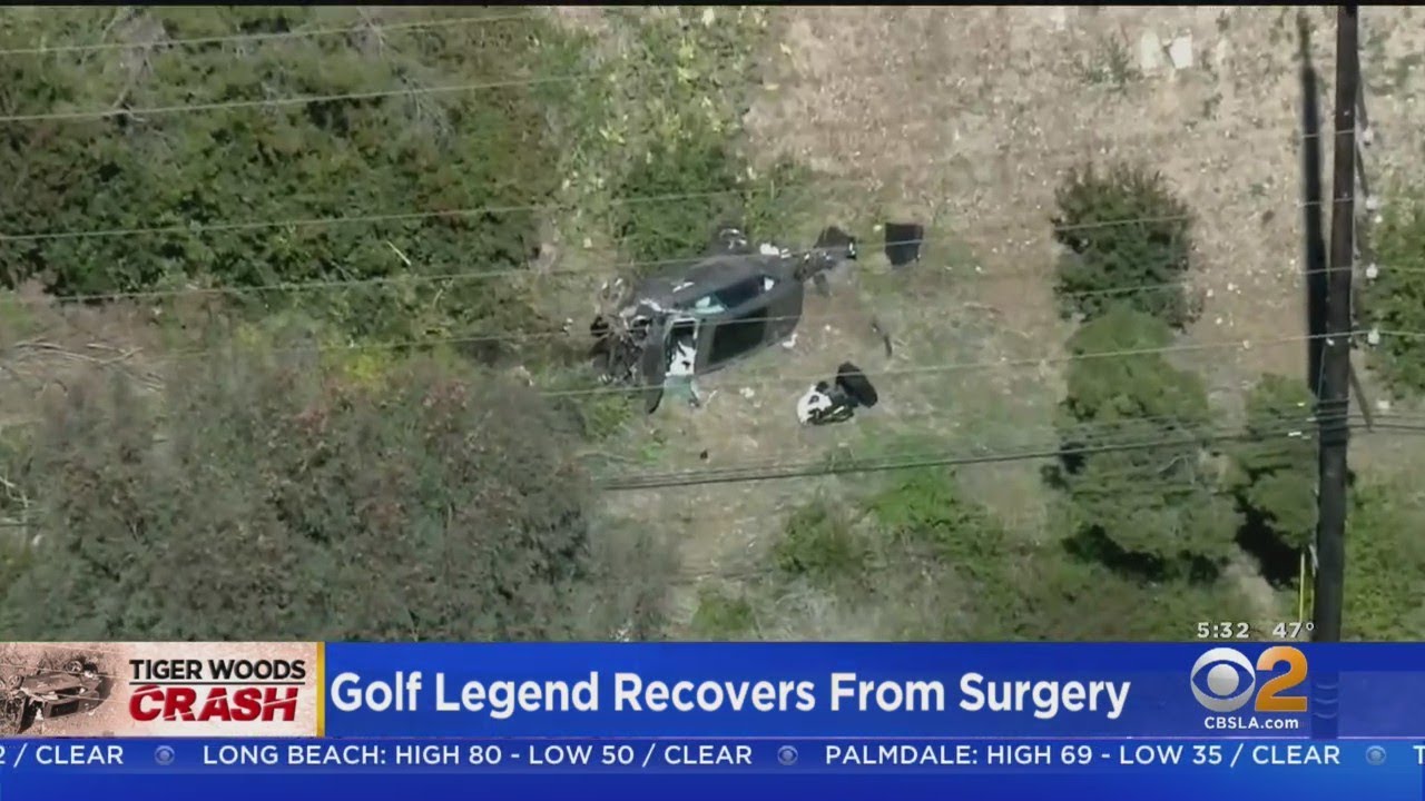Tiger Woods 'Responsive And Recovering' After Suffering Serious Leg, Ankle Injuries In Rollover Cras