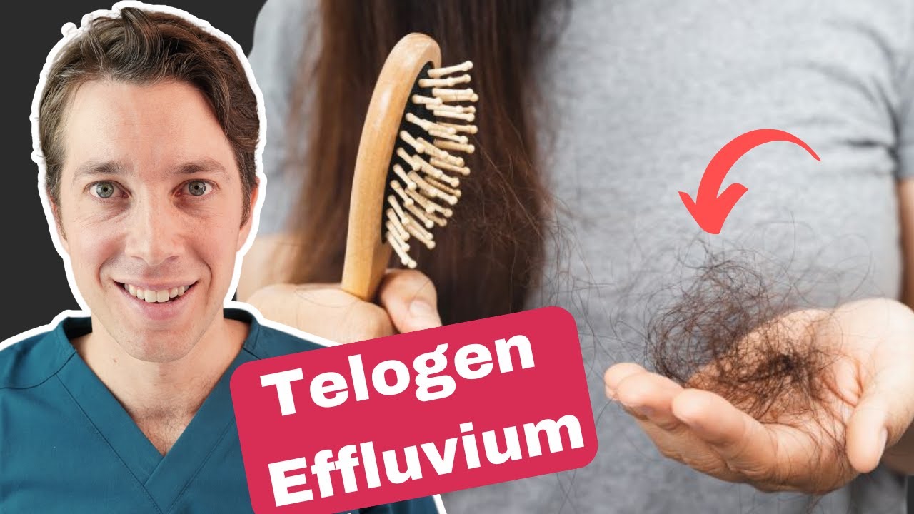 Penjelasan Telogen Effluvium | Perawatan Rambut Rontok Terbaik