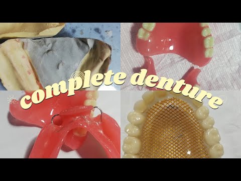 full dentures Complete dentures lab work