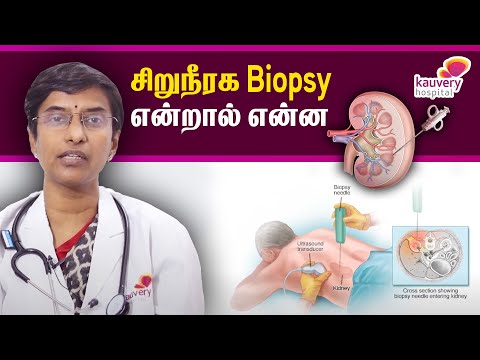 What is Renal Biopsy | சிறுநீரக பயாப்ஸி என்றால் என்ன?