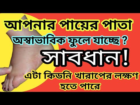 symptoms of kidney problems in bengali | kidney problems symptoms | kidney kharab hone ke lakshan
