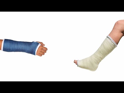 American Sign Language ASL Video Dictionary - plaster bandage
