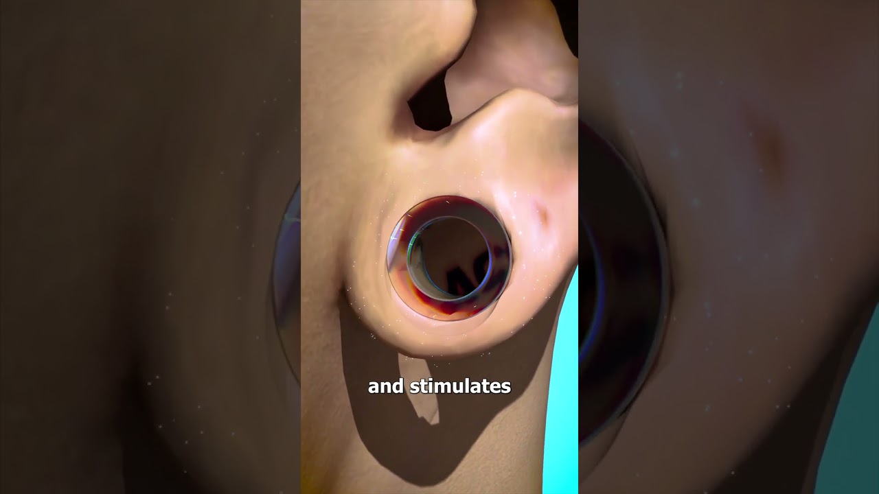 How Ear Gauges Can Tear Your Ears 👂