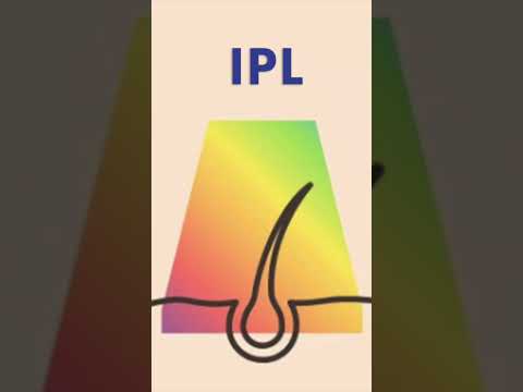Laser vs. IPL: What's the Difference? Why is Laser Much Better than IPL? | Experts Explained