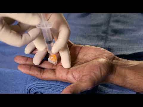 Peripheral Nerve Blocks for Hand Procedures | NEJM