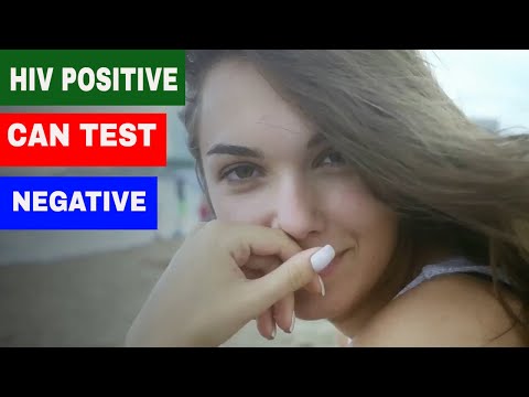 can you be HIV positive and test negative -false hiv negative test