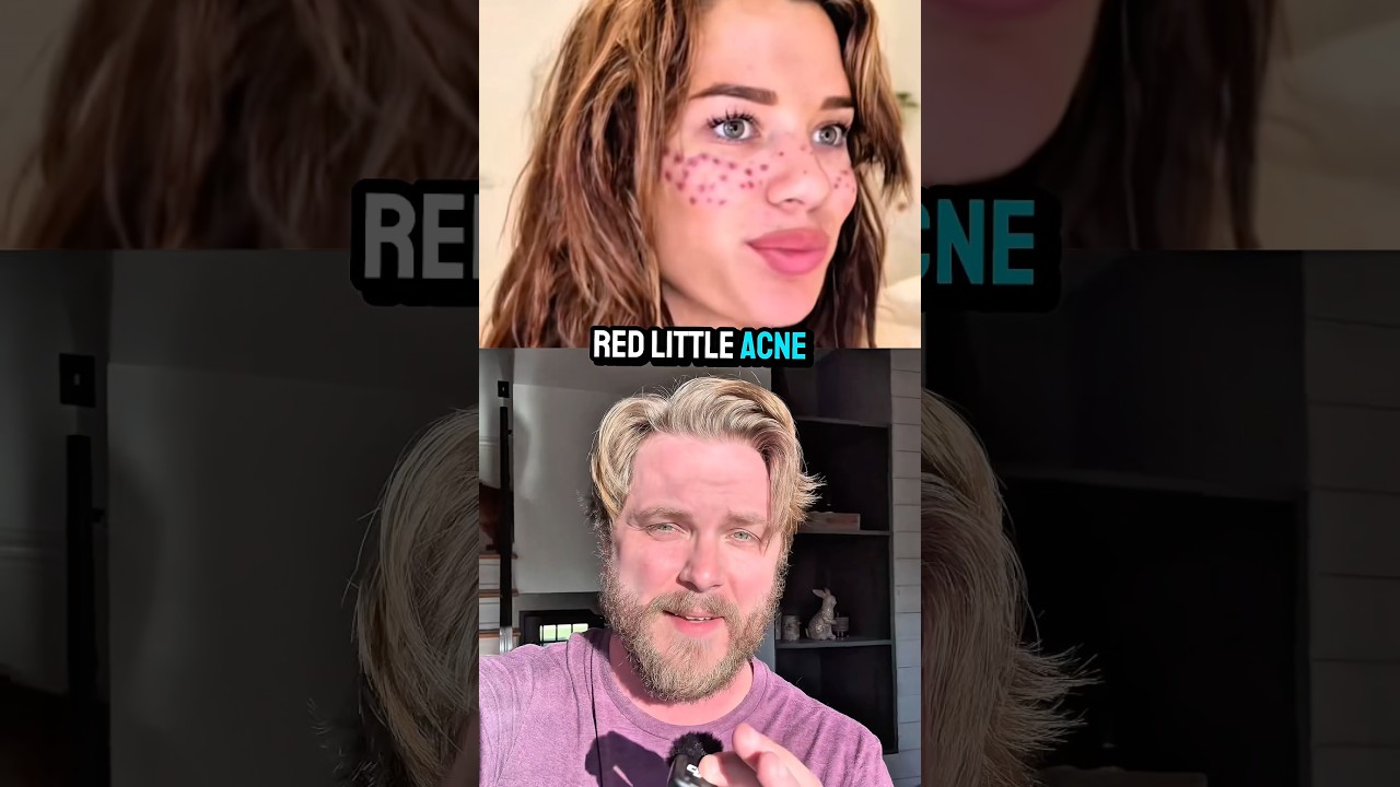 Tattoos you should probably avoid - Part 64