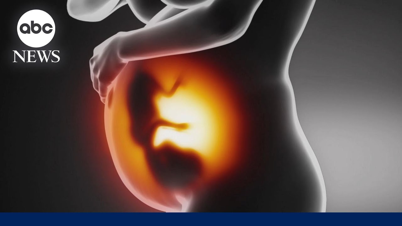 Woman criminally charged after miscarriage in Ohio